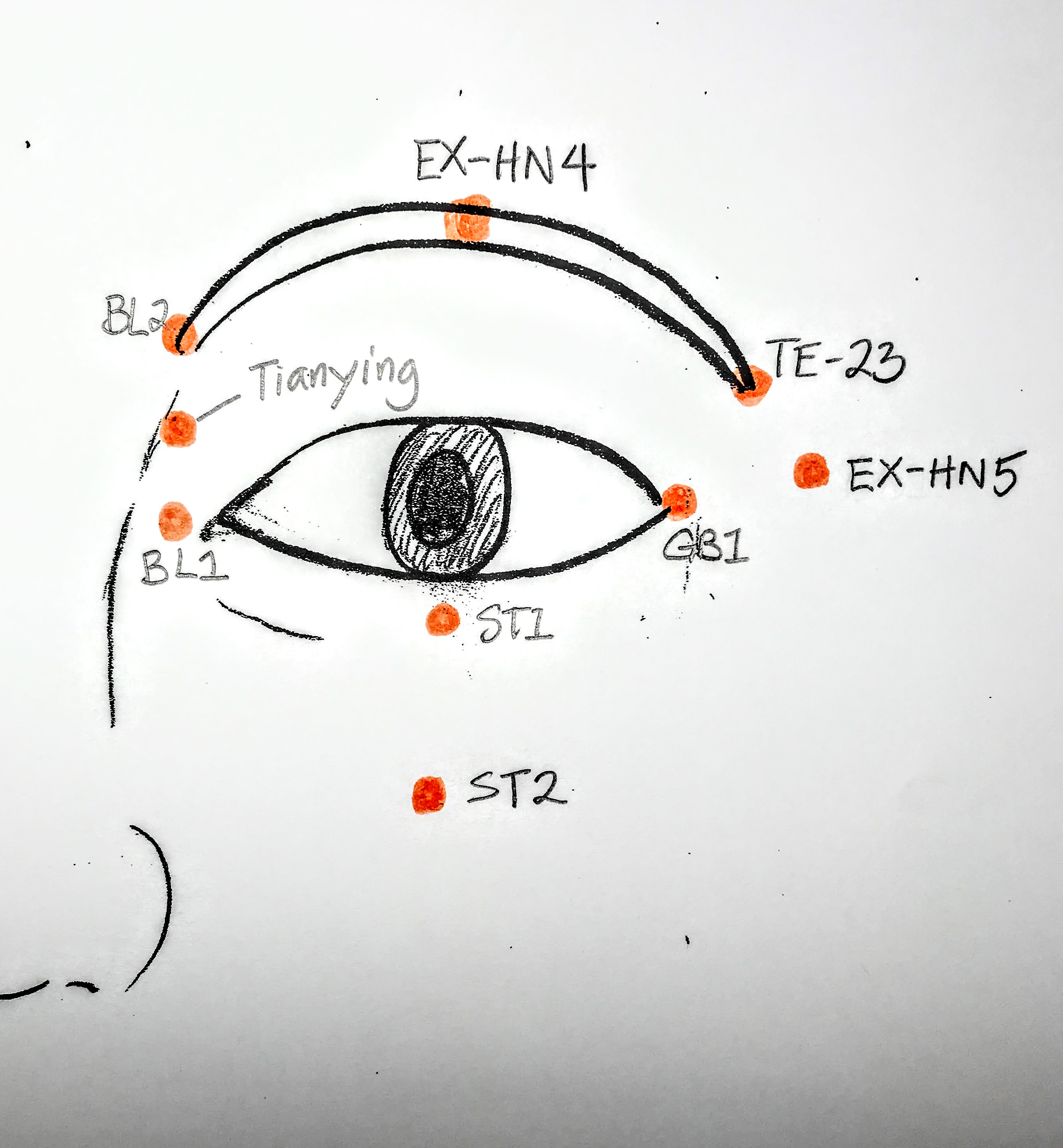 Eye Massage and Eye Acupressure Points for Myopia – Things I wish I ...
