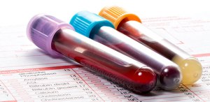 Get Lab Tests Without a Doctor: Take Charge of Your Health – Things I ...